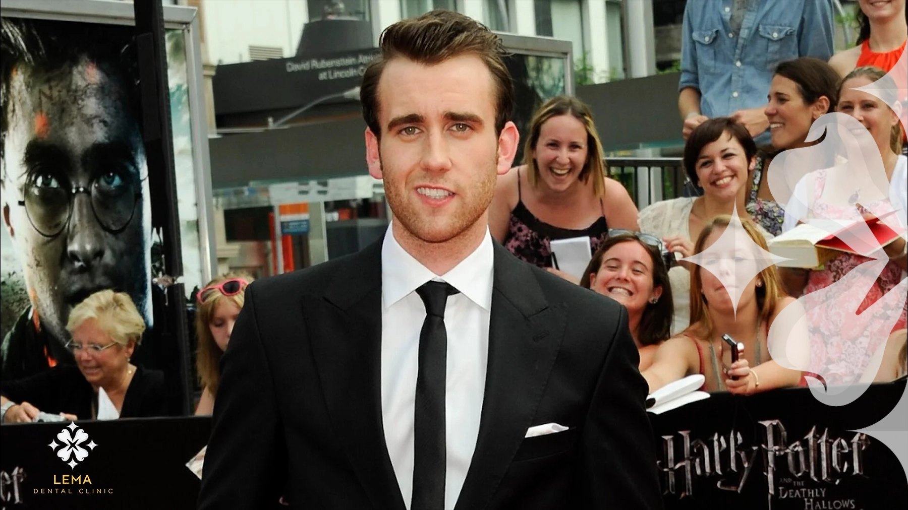 How Matthew Lewis Transformed His Neville Longbottom Smile with Veneers ...