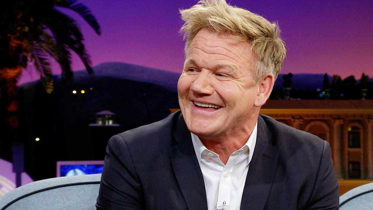 Gordon Ramsay Teeth Transformation | DentPrime