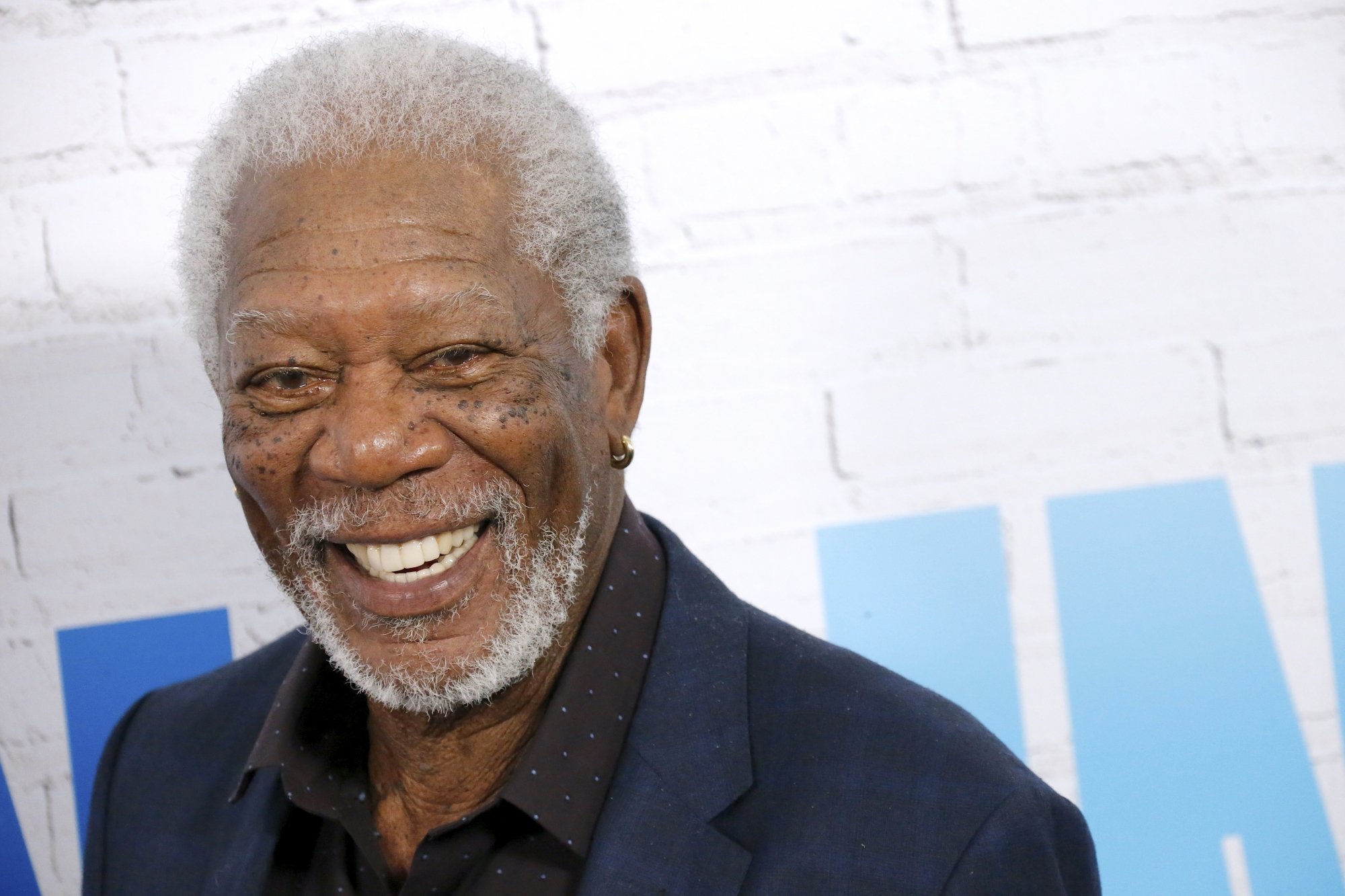 Morgan Freeman’s Smile Journey with Veneers and Subtle Restoration