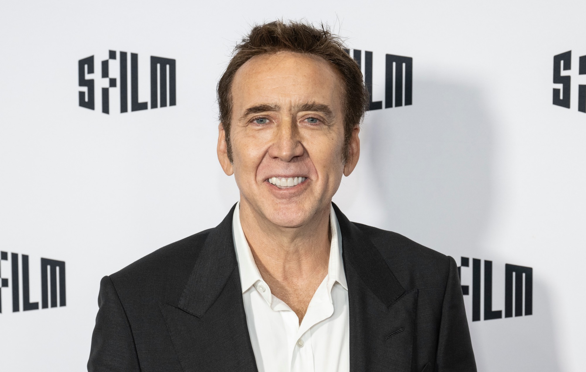 How Nicolas Cage Enhanced His Smile with Veneers and Cosmetic Refinement