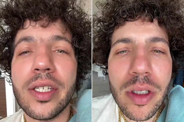 Benny Blanco Teeth Before and After | DentPrime