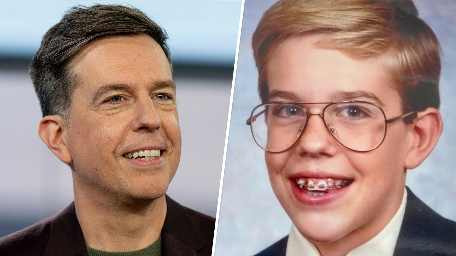 Ed Helms Teeth Year by Year: The Evolution of a Genuine Hollywood Smile