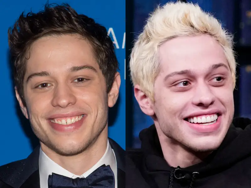 Pete Davidson Teeth: The Story Behind His Iconic Smile