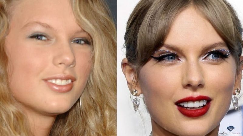 Taylor Swift Teeth: The Enduring Legacy of a Signature Smile