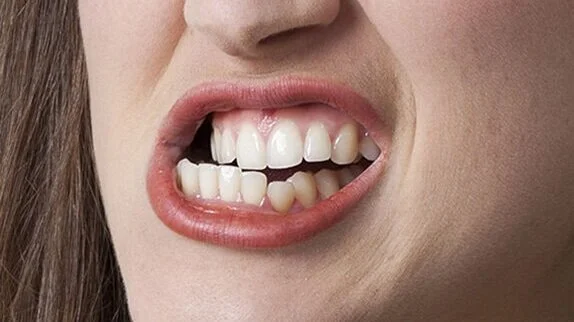 Gnashing of Teeth: Causes, Effects, and Effective Management