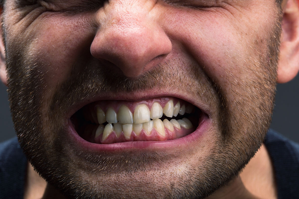 Gritting Teeth: 5 Signs You Shouldn’t Ignore | DentPrime